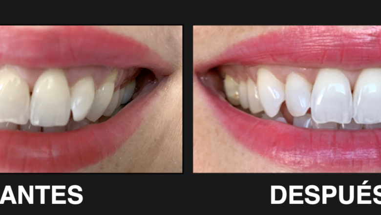 Colgate lanza la nueva pasta de dientes Max White Ultra para una ...